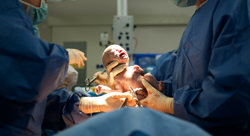 You ll Be Shocked To See What An Emergency C section Is Really Like You ll Be Shocked To See What An Emergency C section Is Really Like