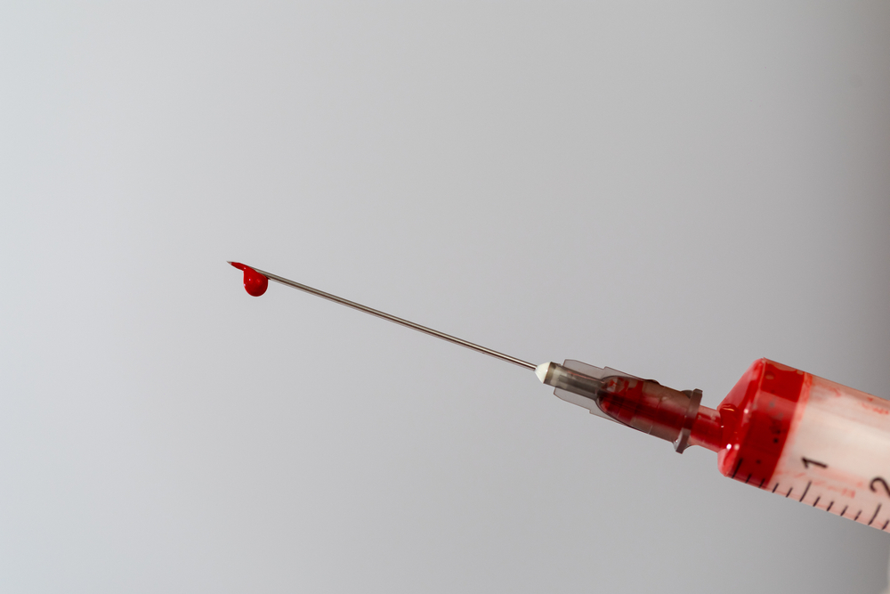 What Causes Fainting And How To Prevent It During Needle Procedures ...