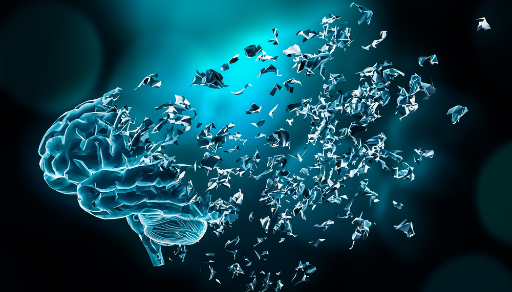It's not brain surgery: People with Parkinson's need better care in the ...